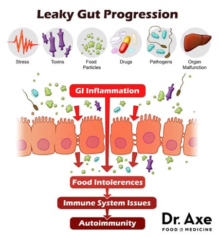 Leaky Gut Test: Integrated Wellness Clinic